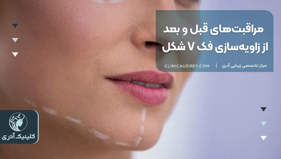 زاویه فک v شکل | چگونه صورت v شکل داشته باشیم؟+[4 روش]